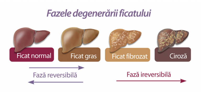 Ficatul - Asociatia Prietenii lui Adrian